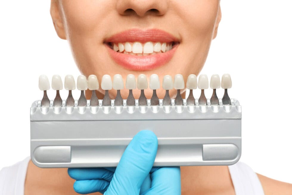 Choose the Right Color and Size of Veneers| Thomas F. Brown, DDS